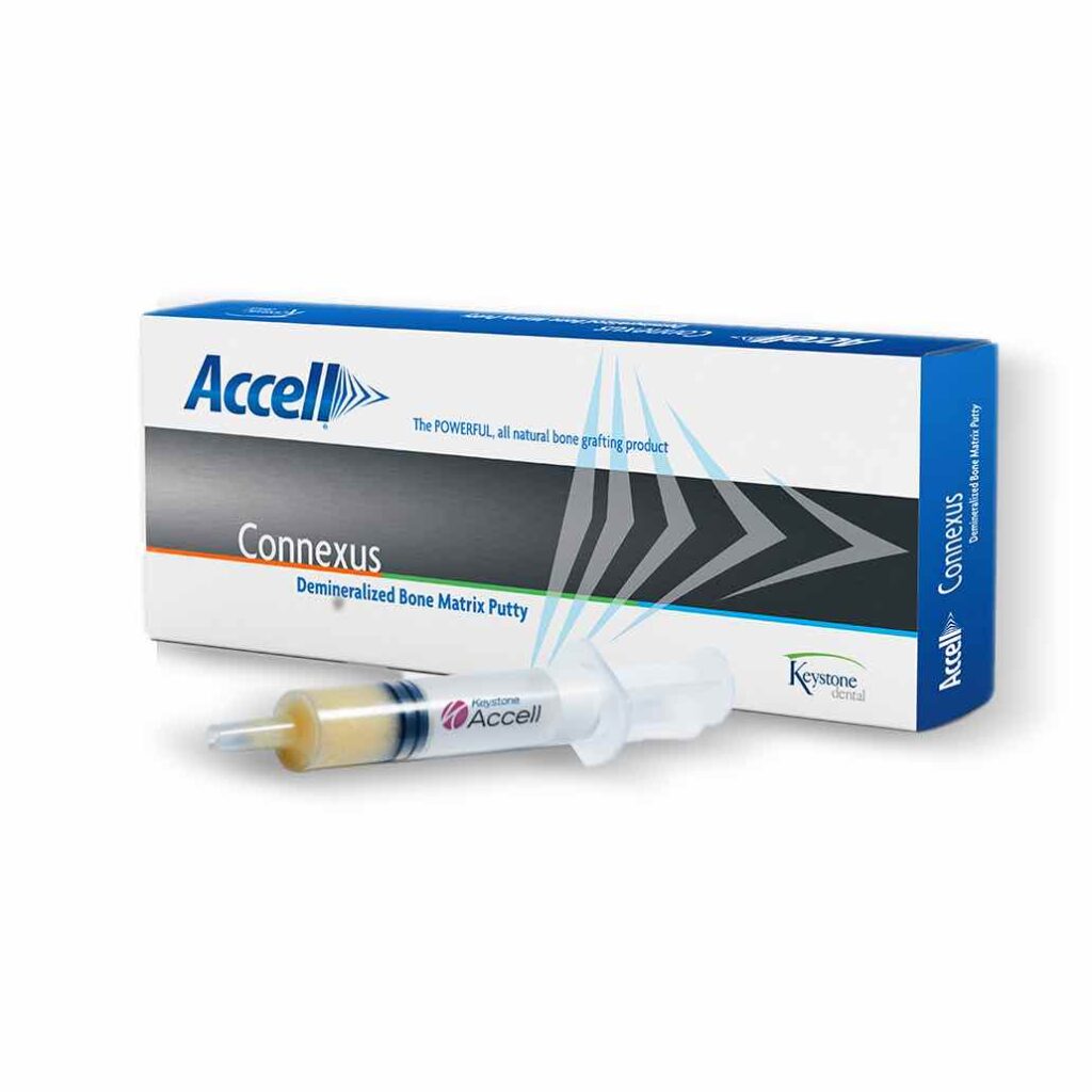 Putty DBM Accell Connexus Accell Connexus | Soluciones para Traumatología y Ortopedia en México ...